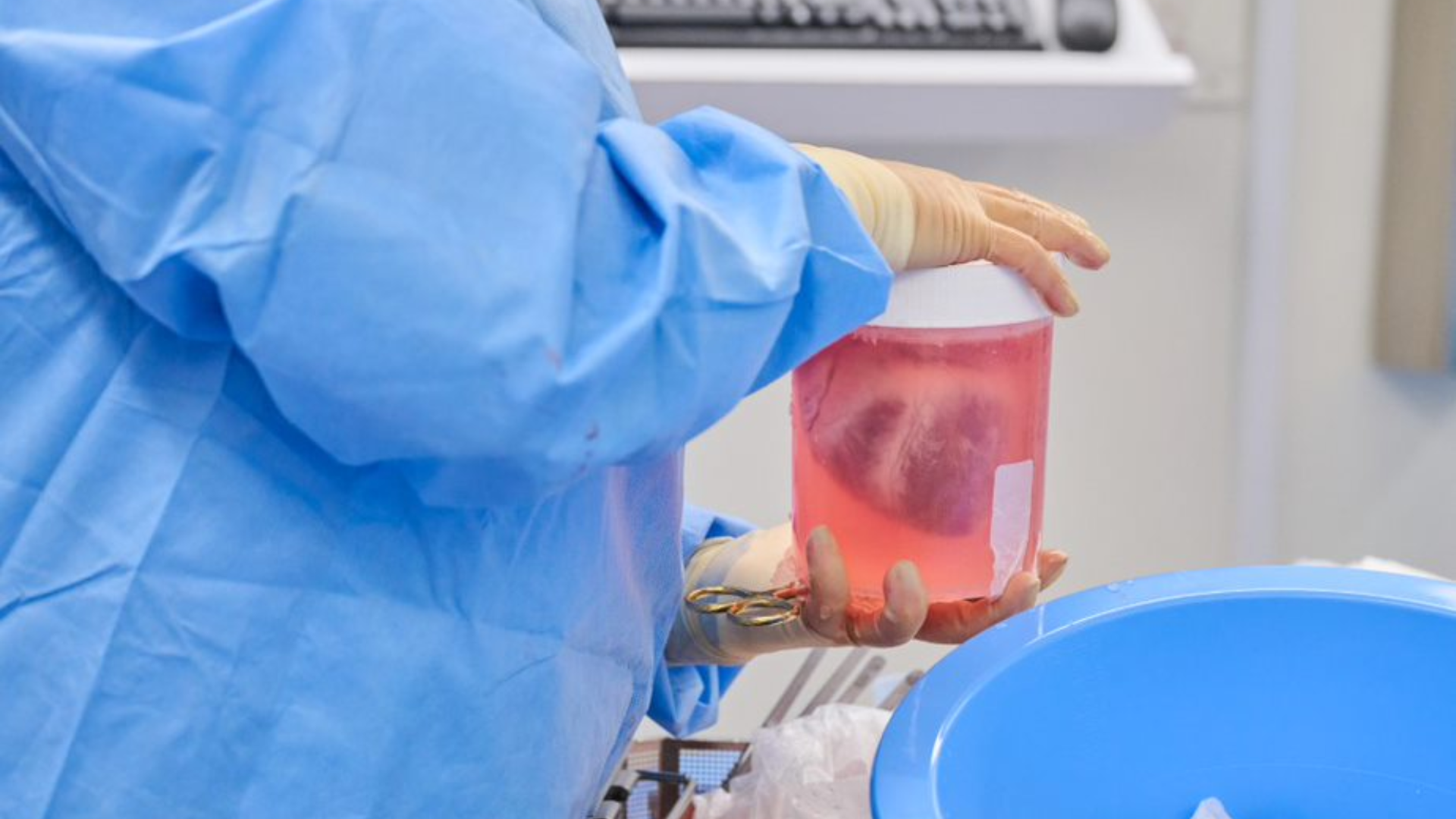 Genetically modified pig hearts transplanted into two more patients