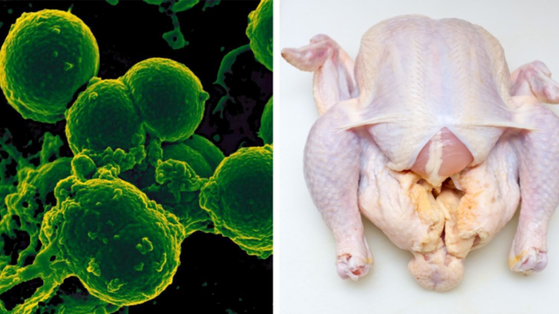 Why antibiotic resistance is becoming an unfixable problem