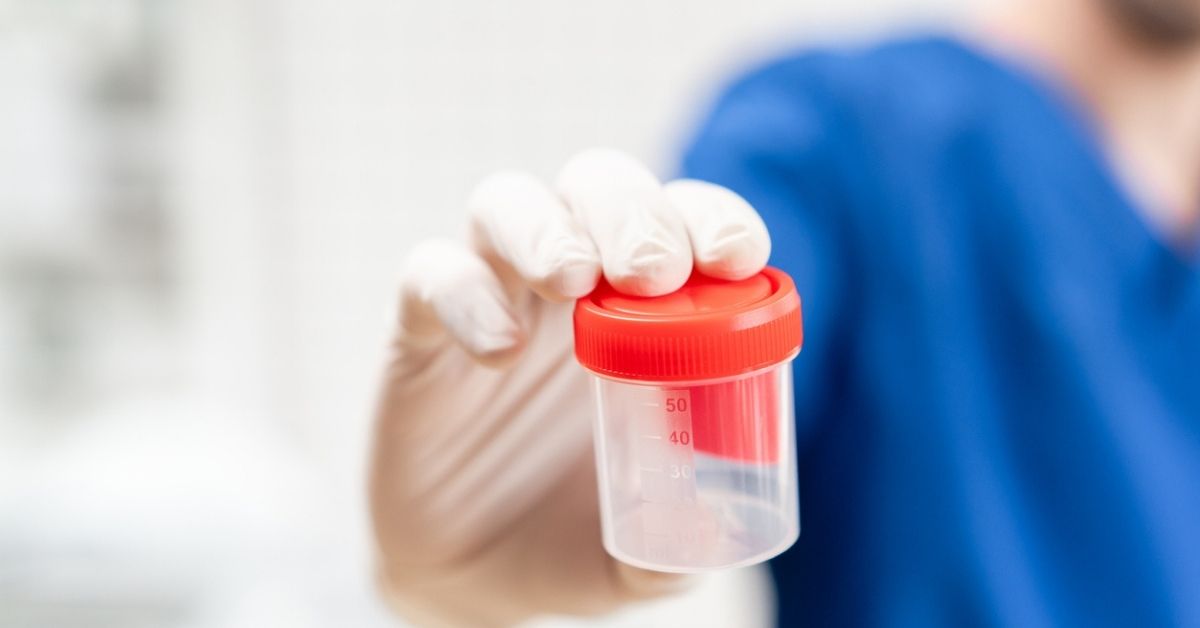 Scientists Use AI and Urine to Diagnose Prostate Cancer
