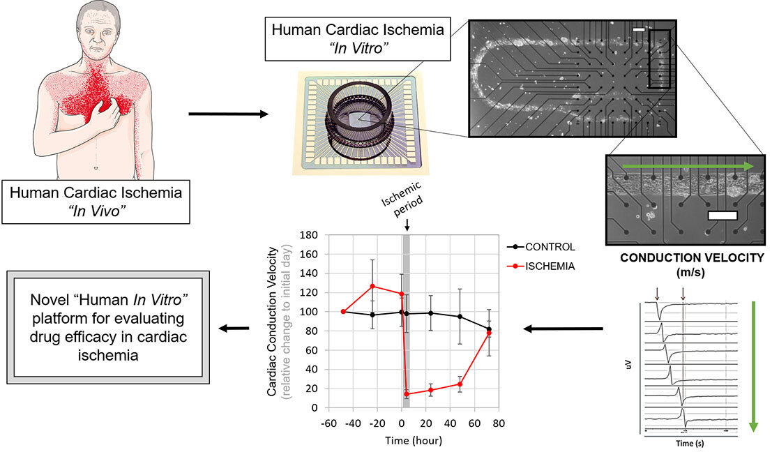 New Silicon 'Heart-on-a-Chip' Lets Scientists Assess Cardiac Drug Reactions