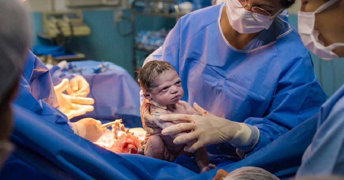 Picture Captures Newborn Baby Glaring at Doctors Immediately After Birth