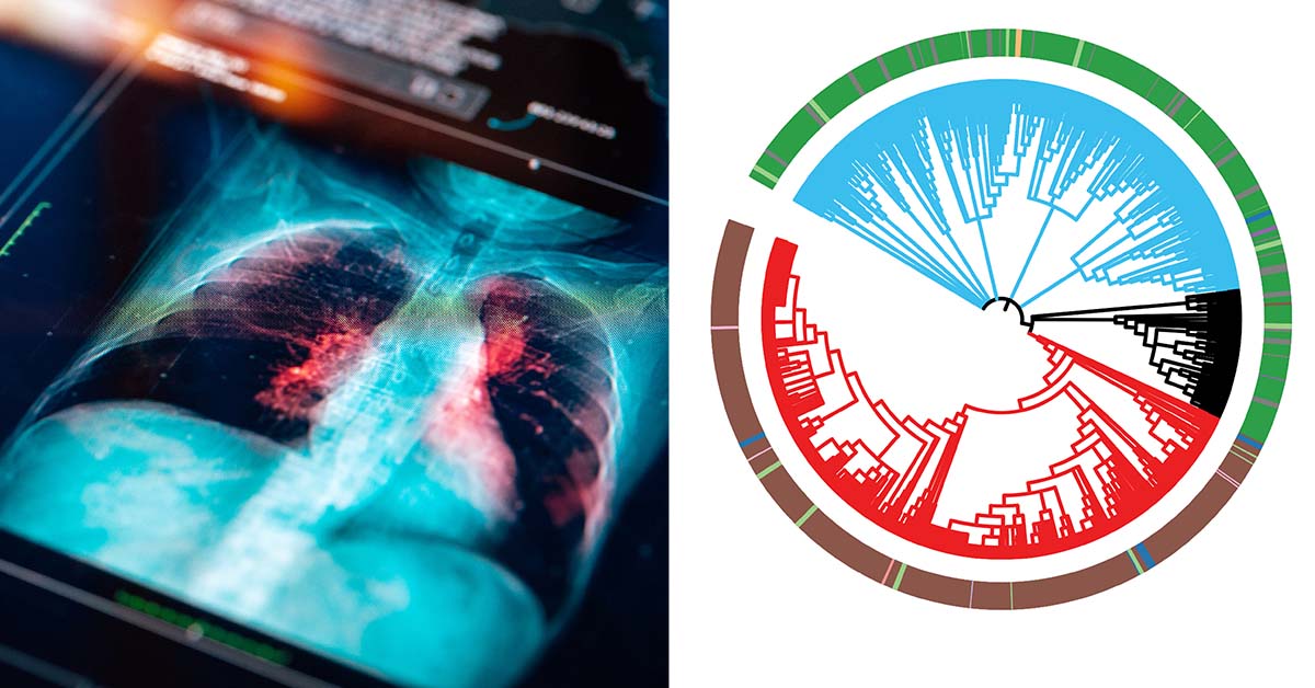 This 'family tree' tells the story of how a cancerous tumor grew