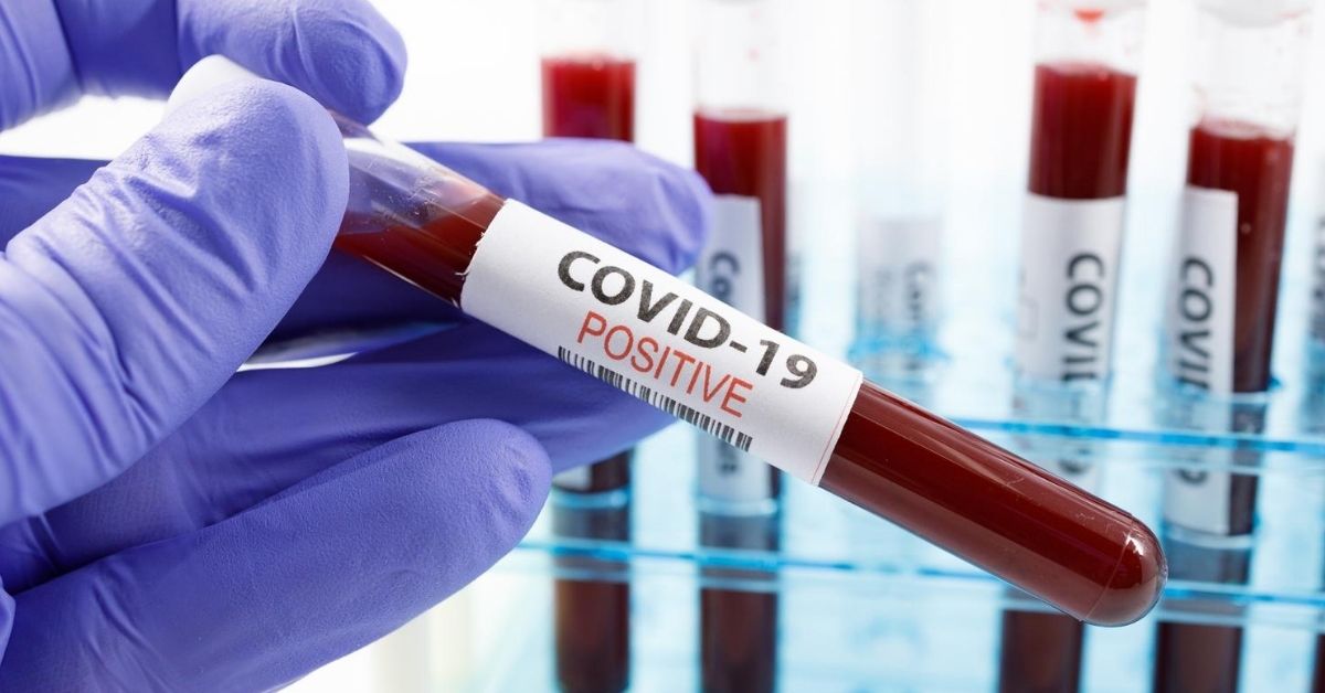 First Covid 19 Reinfection Case Recorded In Hong Kong