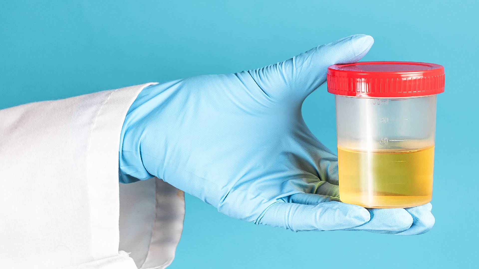 There's an app for that: AI uses sound of urine stream to monitor ...