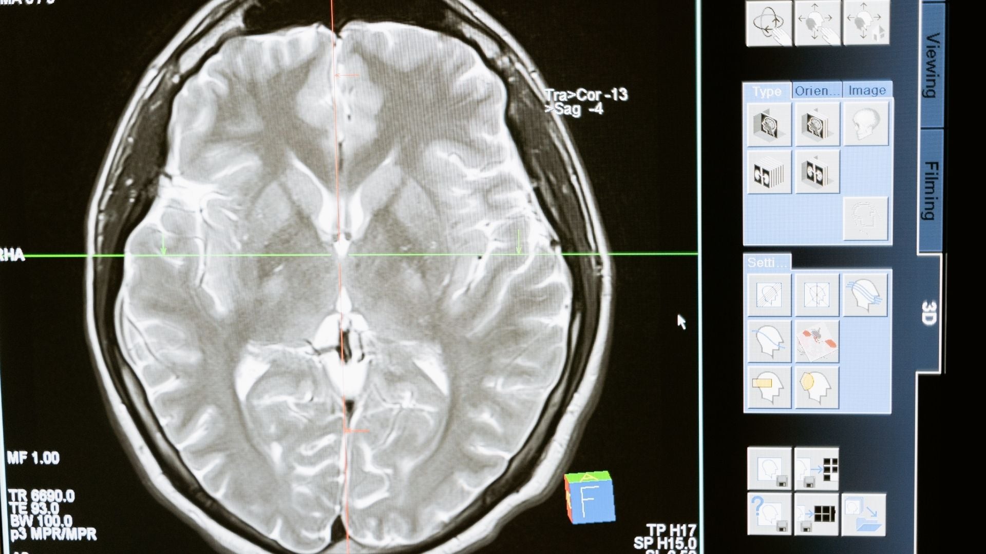 Here's What Sleep Deprivation Does to Your Body and Brain