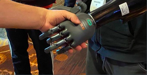Formidable Prosthetic Hand Can Be Controlled Solely with Your Mind