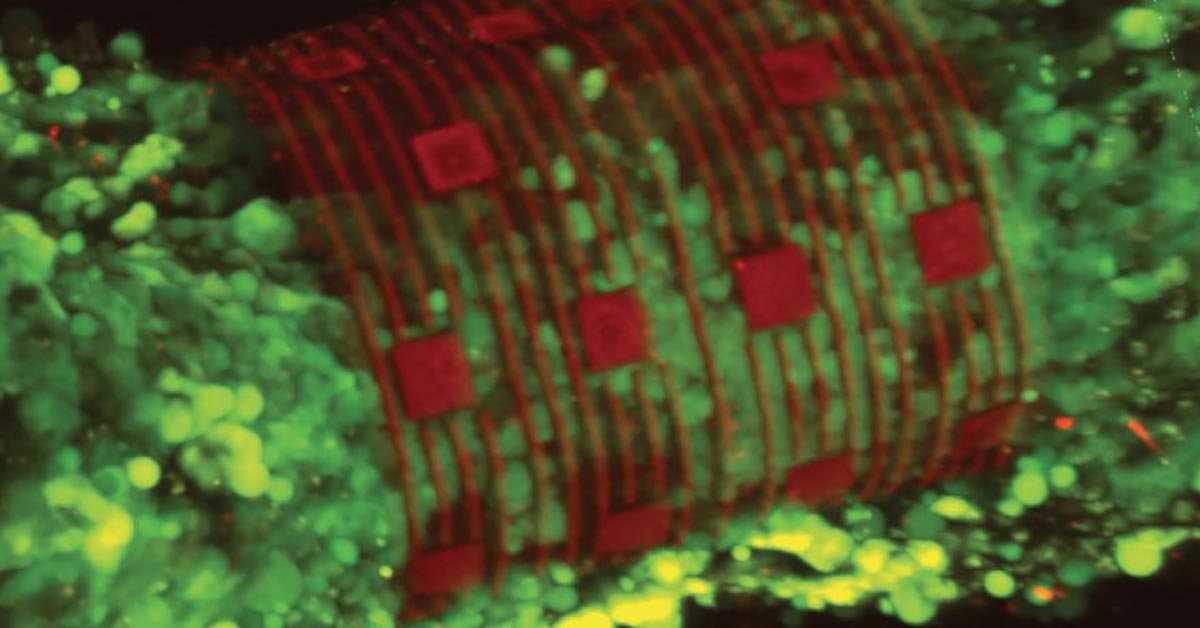 New Slap Bracelet-Like Sensor Studies Heart Cells in Unprecedented Detail