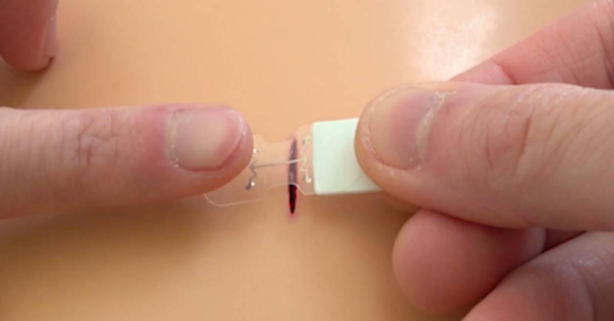 At-Home No-Stitch Wound Healing Kit Fundraises $3 Million