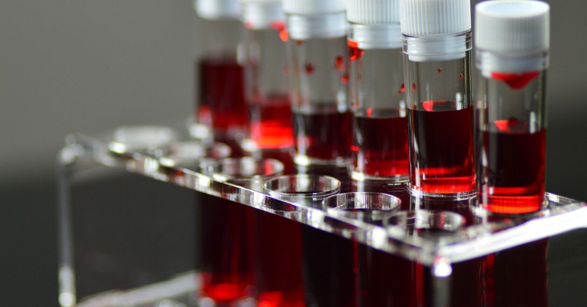 Blood type may determine if you test positive for Covid-19, 23andMe ...