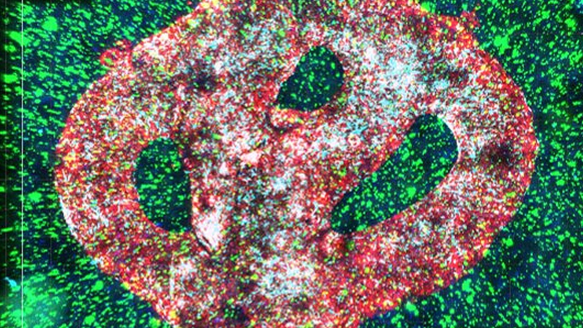 Scientists 3D Printed a Deadly Brain Tumor for the First Time