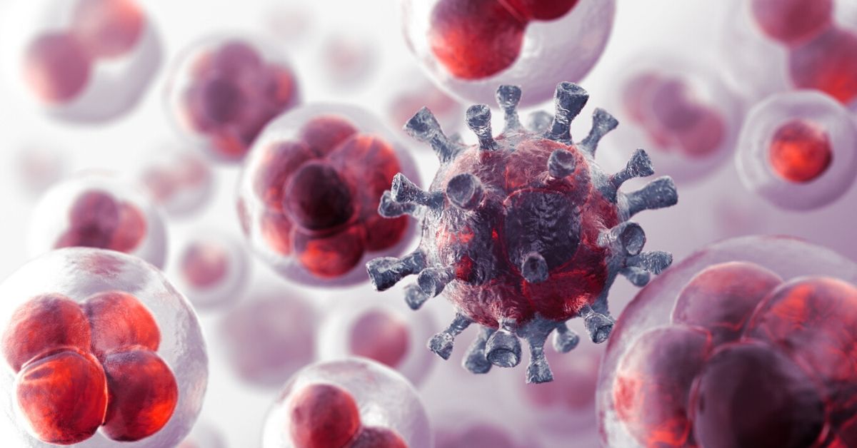 Ultrasound Can Selectively Eradicate Cancer Cells, Researchers Find