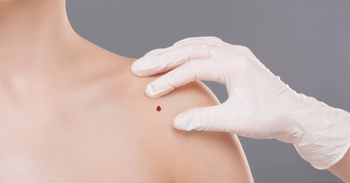 Scientists Invent Wearable Patch That Provides New Treatment for Skin ...