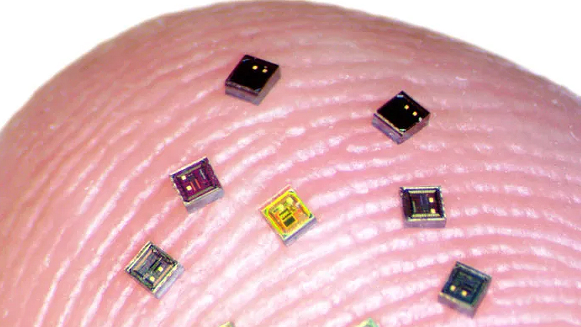 Dumping Hundreds of Microchips Into Your Brain Could Help Epilepsy Research