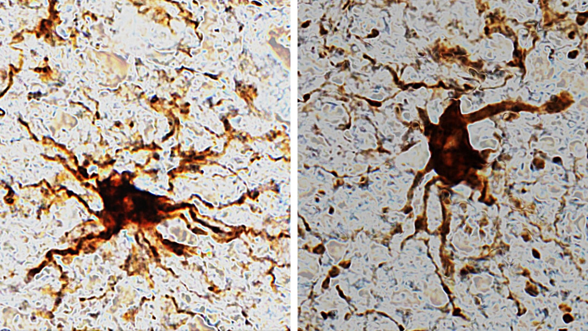 Your Brain Has 'Zombie' Cells That Actually Grow After You Die