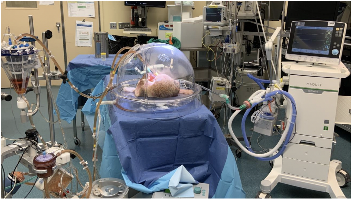 Scientists create universal blood-type organs for transplant