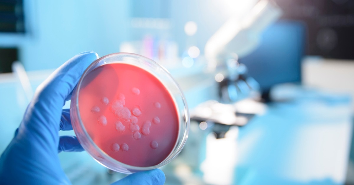 Explosion At Russia Lab Storing Ebola, Smallpox Has Twittersphere Worried