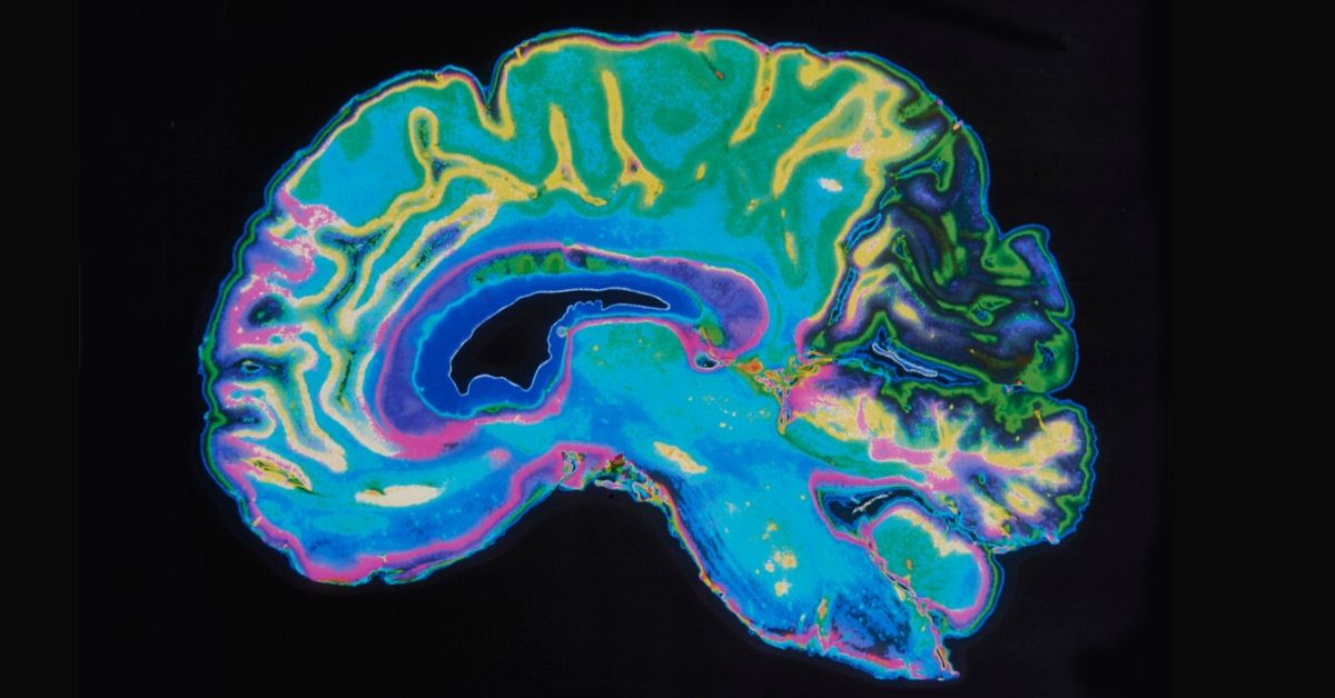 Scientists Create AI That Turns Thoughts into Text