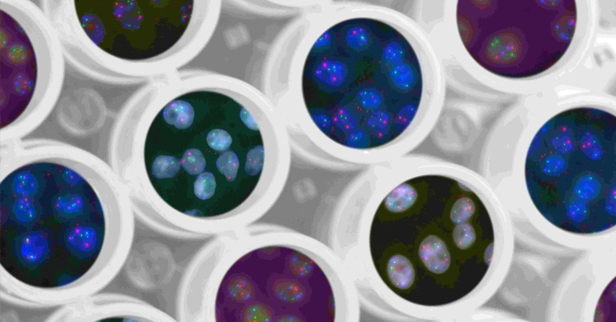 New Gene Sequencing Software Cuts Cost, Five Times Faster, Say Scientists