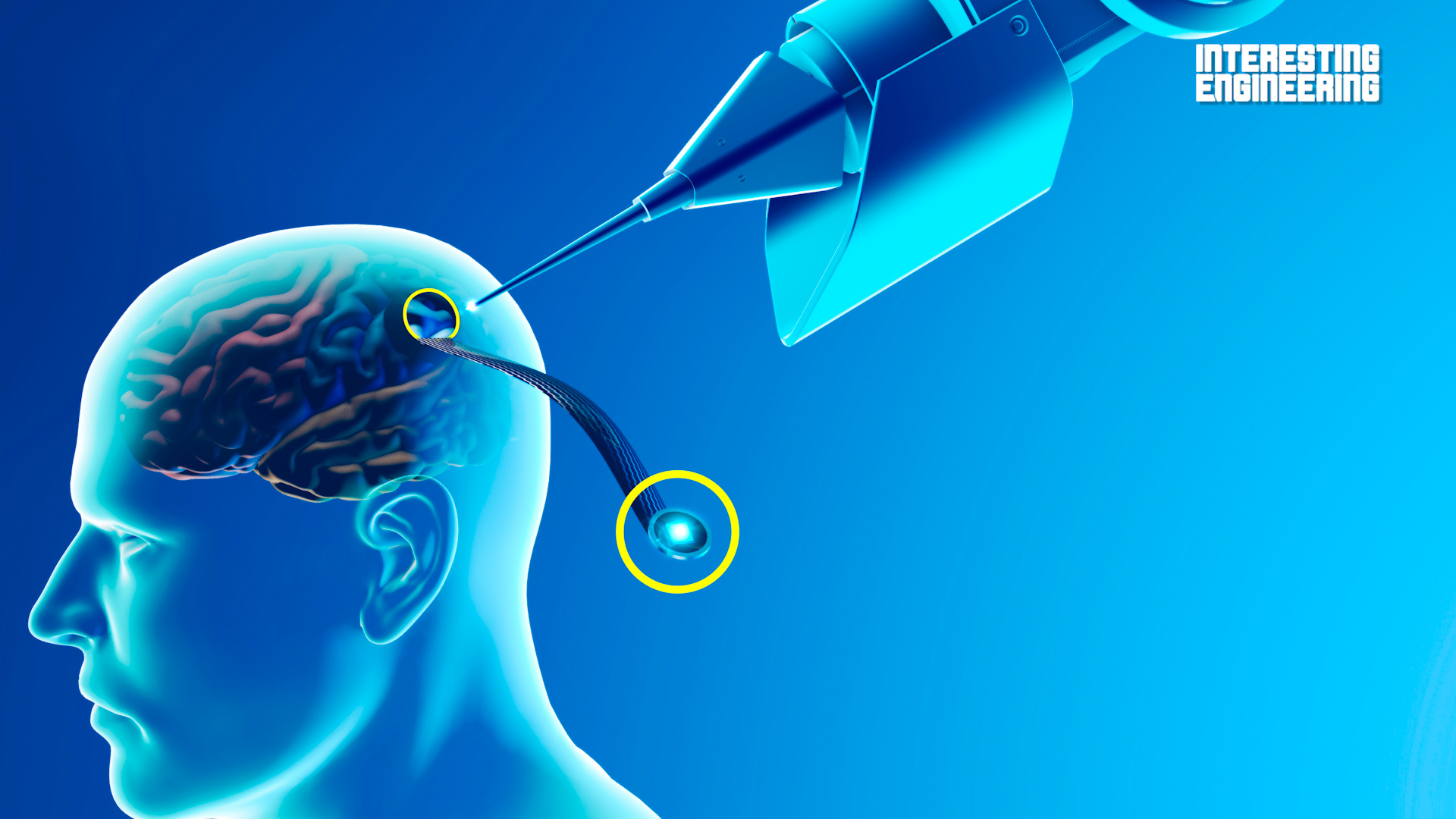 What We Know So Far About Elon Musk’s Neuralink